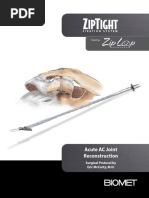 AC Joint Repair Arthrex | PDF | Surgical Suture | Joints