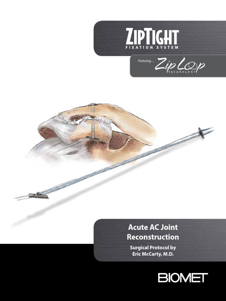 Ziptight Fixation System For Acute Ac Joint Reconstruction Surgical ...