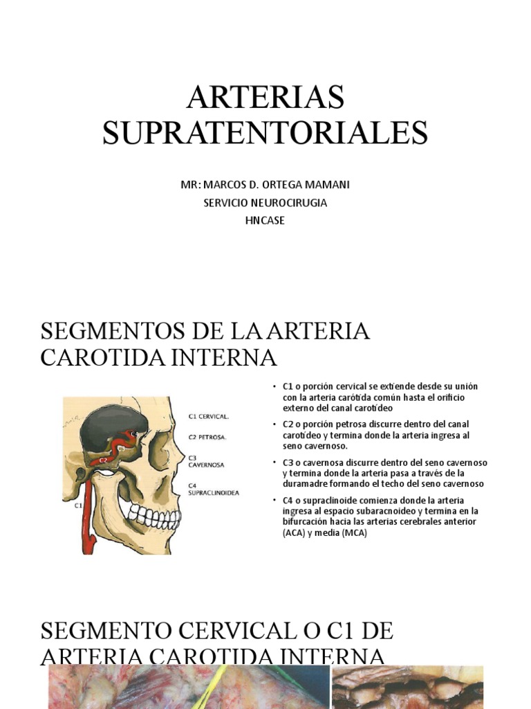 Arterias Supratentoriales | PDF | Anatomía humana | Sistema nervioso