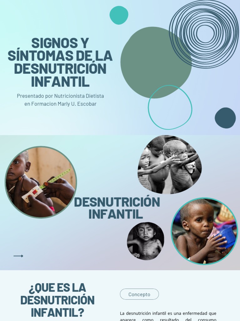 Signos Y Síntomas De La Desnutrición Infantil Pdf Nutrición Dieta