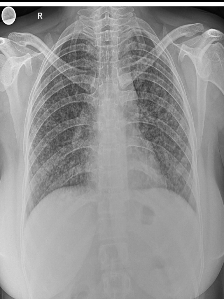 Latihan Kasus Foto Thorax Ke | PDF