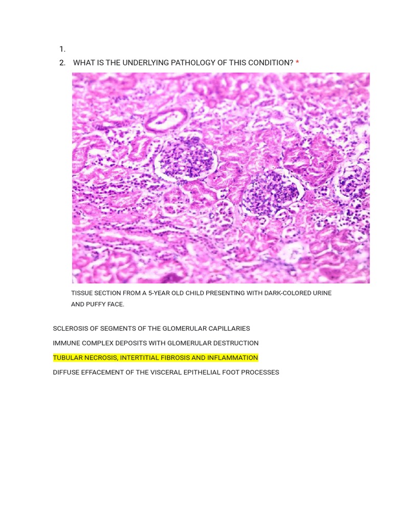 General Pathology Practical Exam Renal Pathology | PDF | Kidney ...