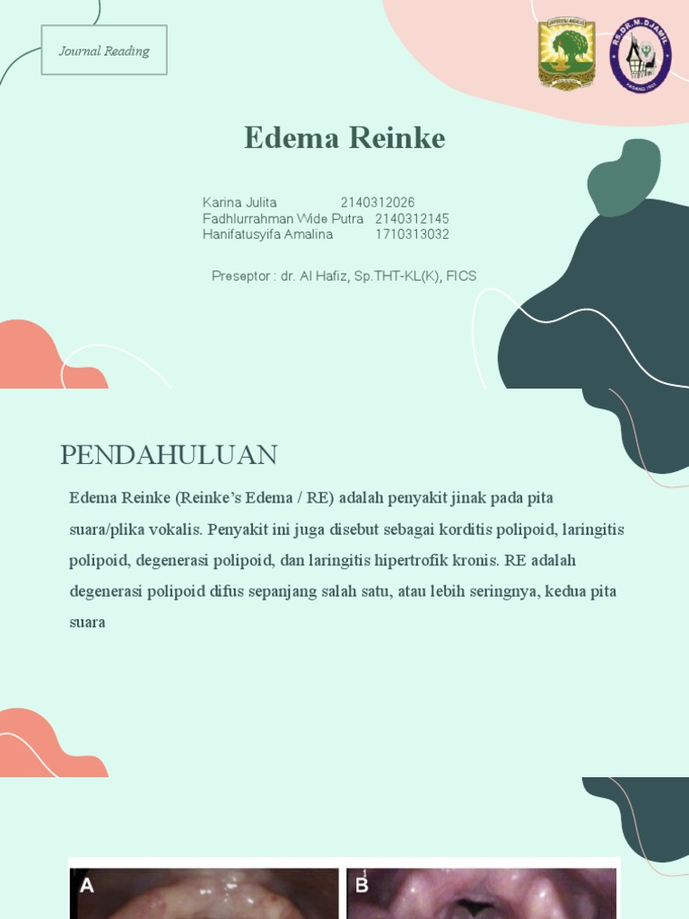 CSS - Edema Reinke | PDF | Sains & Matematika