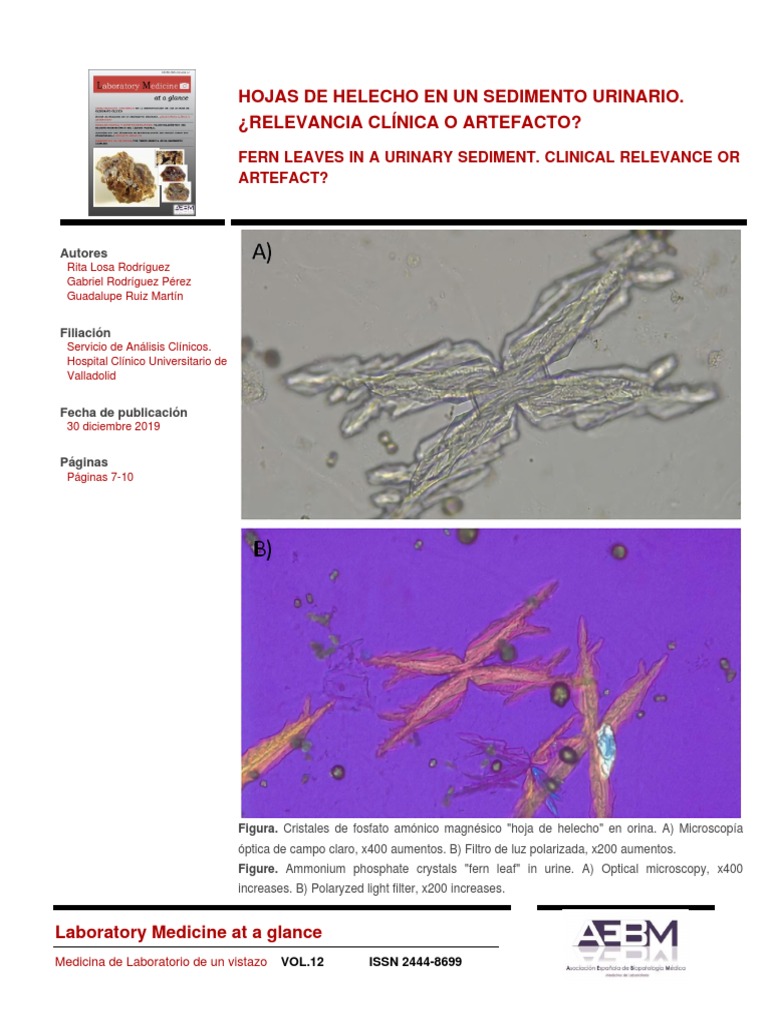 Fern Leaf Crystals in a Urine Sediment: Clinical Relevance or Artefact ...
