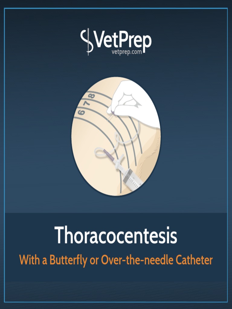 Thoracocentesis: With A Butterfly or Over-The-Needle Catheter | PDF ...