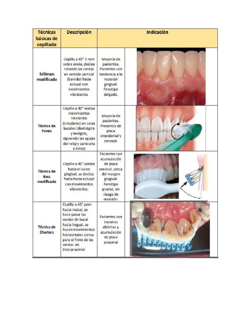Técnicas de cepillado | PDF