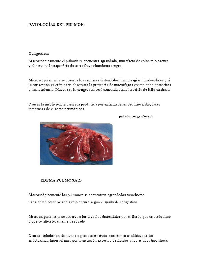 Patologías Pulmonares: Diagnóstico y Causas | PDF | Pulmón | Medicina