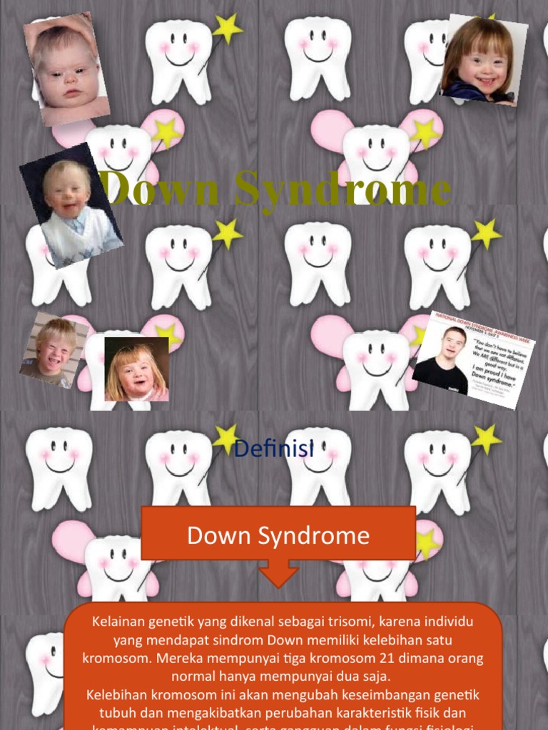Down Syndrome: Definisi dan Penanganan | PDF | Kesehatan Holistik ...
