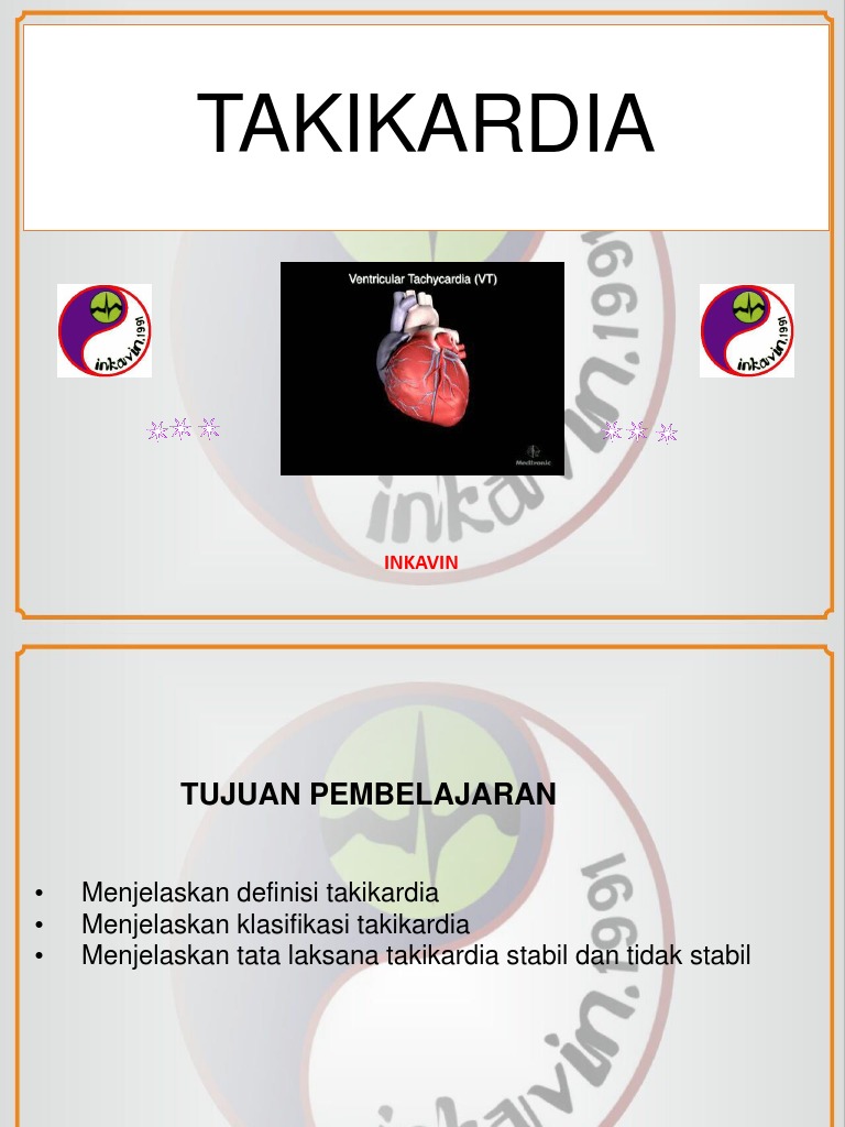 Takikardia Acls | PDF