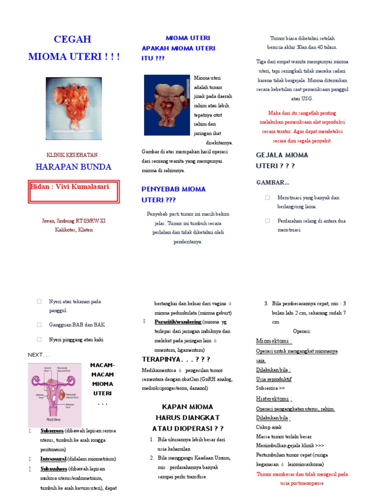Leaflet Mioma Uteri | PDF