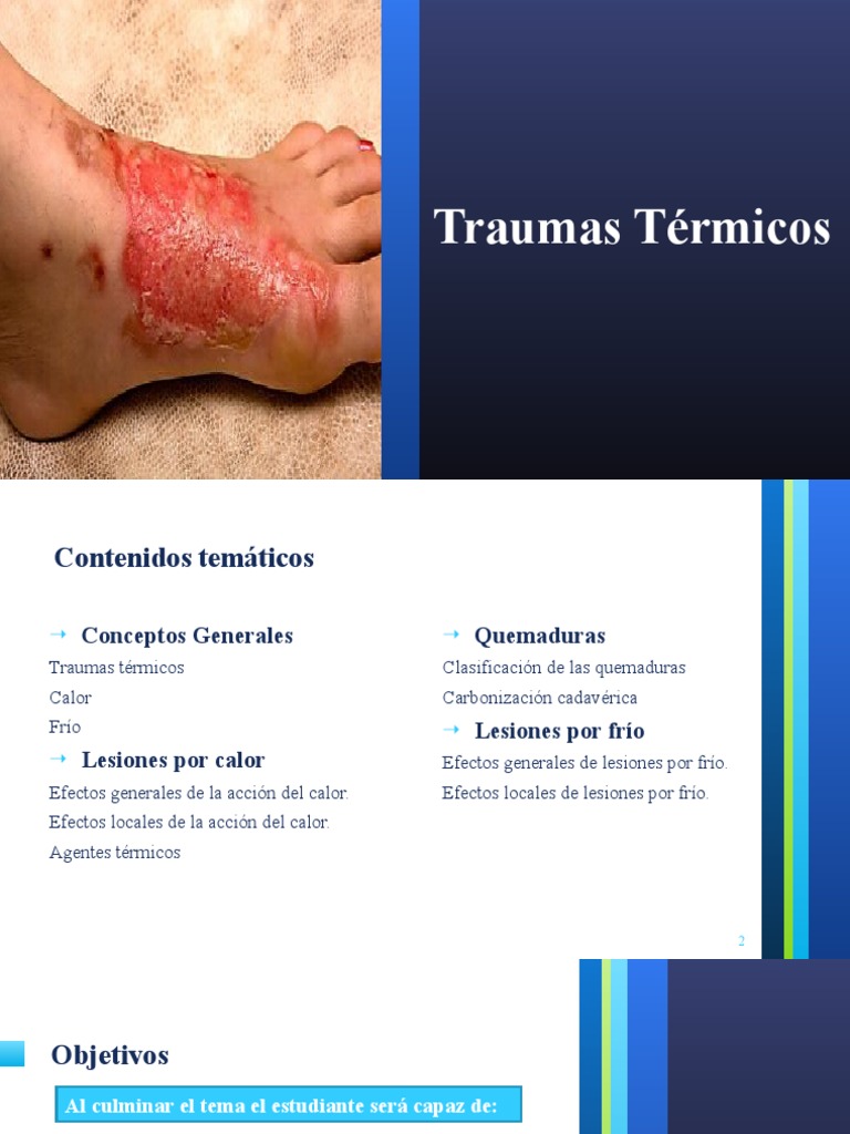 Traumas Térmicos UTESA 21-03 | PDF | Calor | Quemar