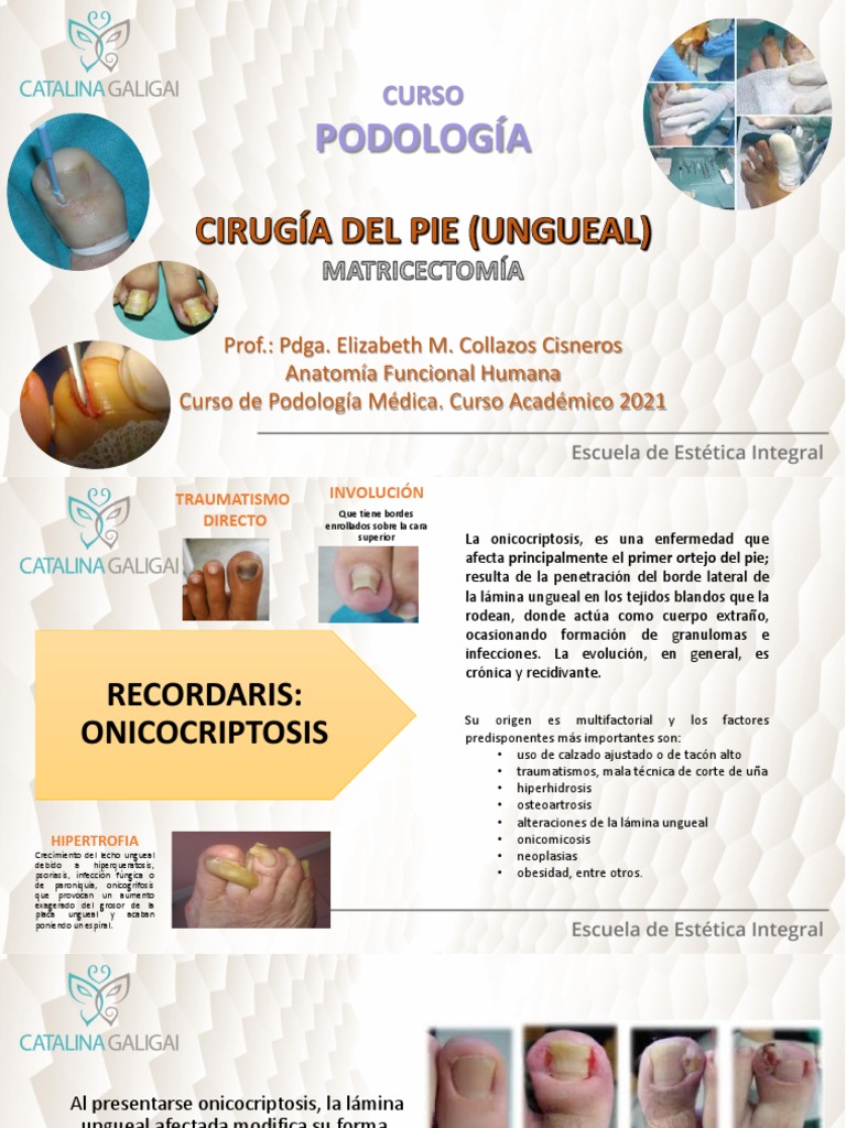 Cirugia Ungueal Matricectomia | PDF | Clavo (anatomía) | Cirugía