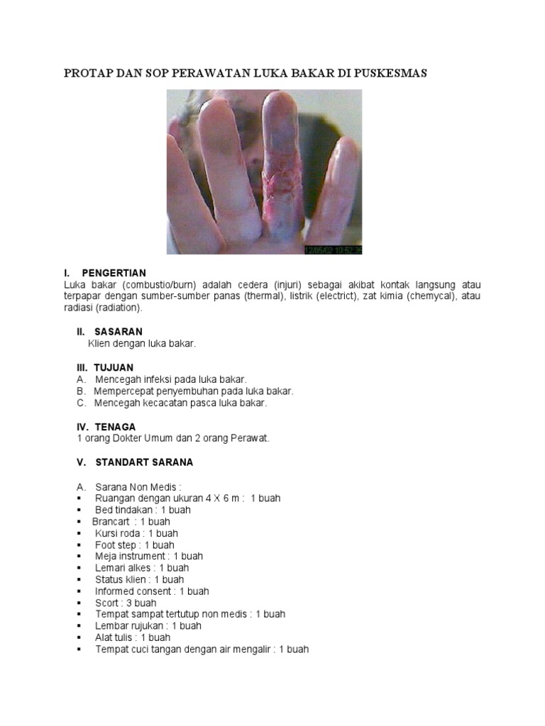 Protap Perawatan Luka Bakar Puskesmas | PDF