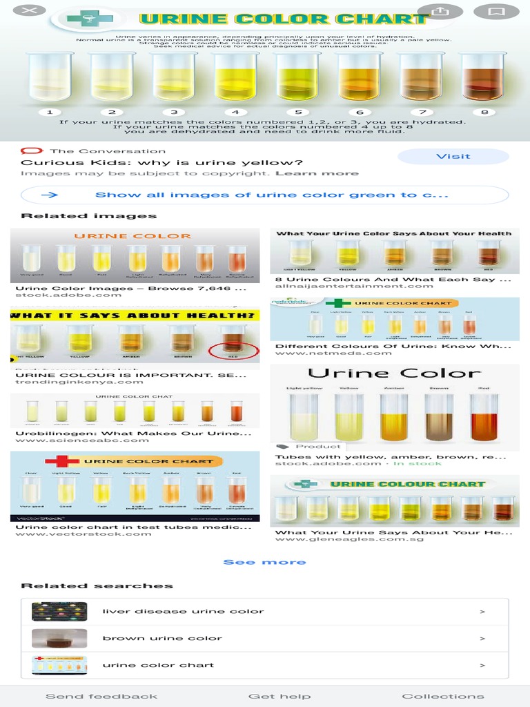 Urine Color Green To Children's - Google Search | PDF | Clinical ...