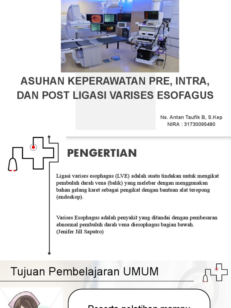 Ligasi Varises Esofagus by Antan | PDF