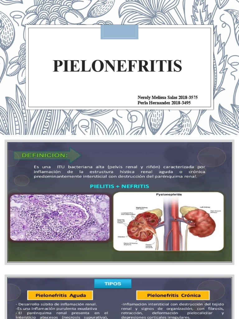 Pielonefritis | PDF