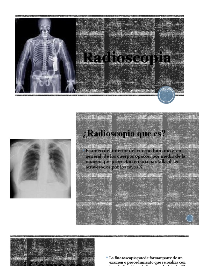 Qué es la radioscopia y su uso | PDF | Rayo X | Especialidades Medicas