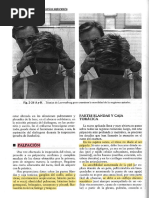 Signo de Dunphy | PDF