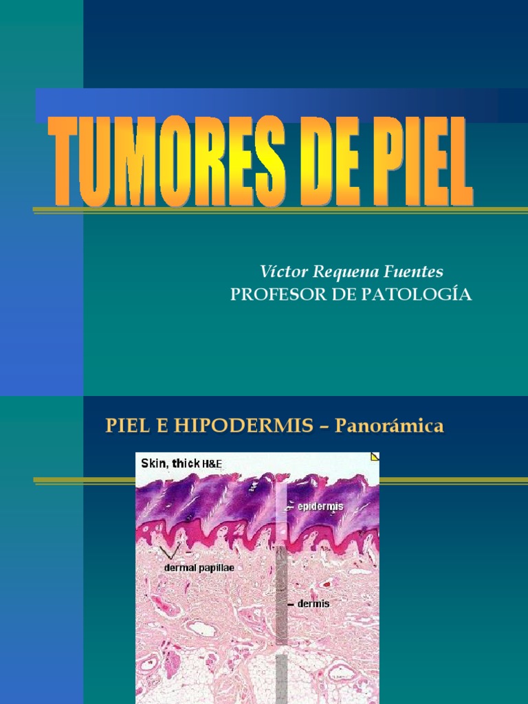 t6. Tumores de Piel (Dr. Requena) | PDF | Piel | Cáncer