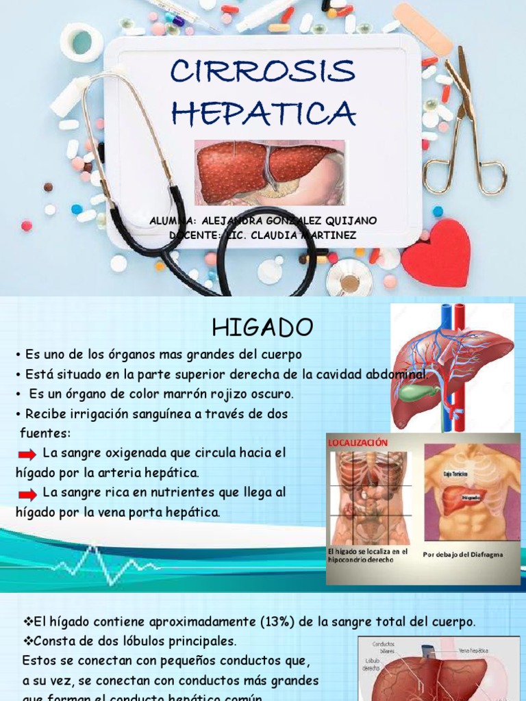 Cirrosis hepática: causas, síntomas y tratamiento | PDF | Cirrosis | Hígado
