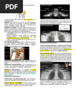 Anatomía del triángulo de Calot y Buddé | PDF | Vesícula biliar | Hígado