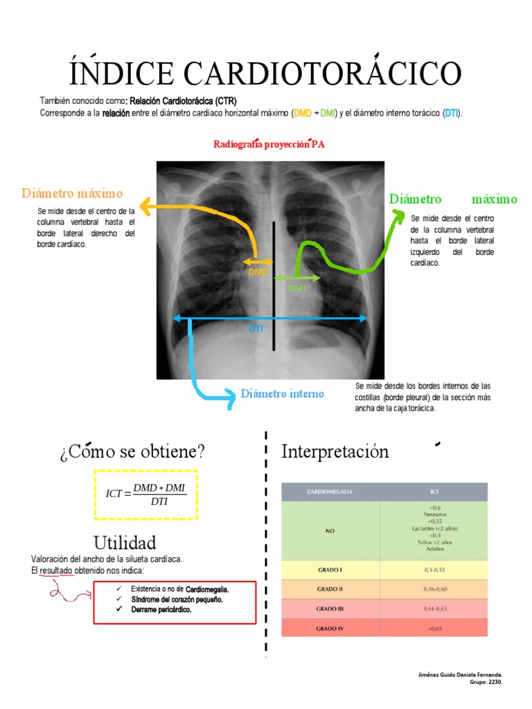 Índice Cardiotorácico: Cálculo y Utilidad | PDF | Corazón | Medicina ...