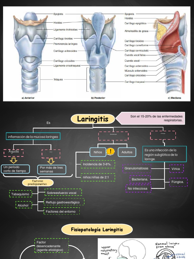 Laringitis: Tipos, Causas y Tratamiento | PDF | Tos | Enfermedades y ...
