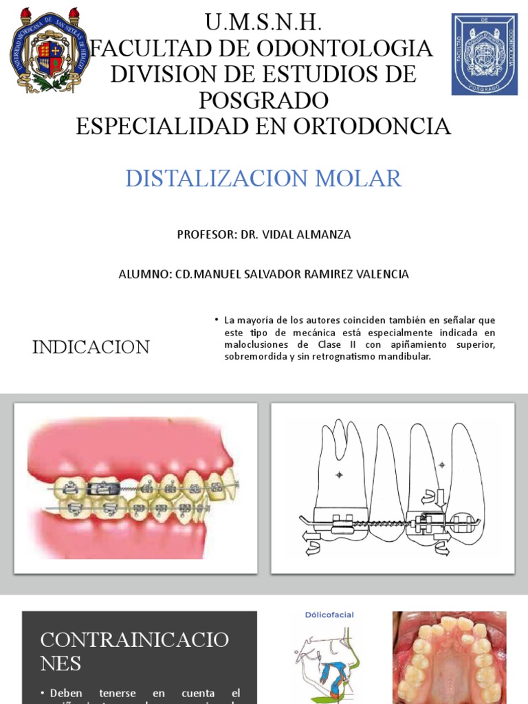 distalización | PDF | Odontología | Boca