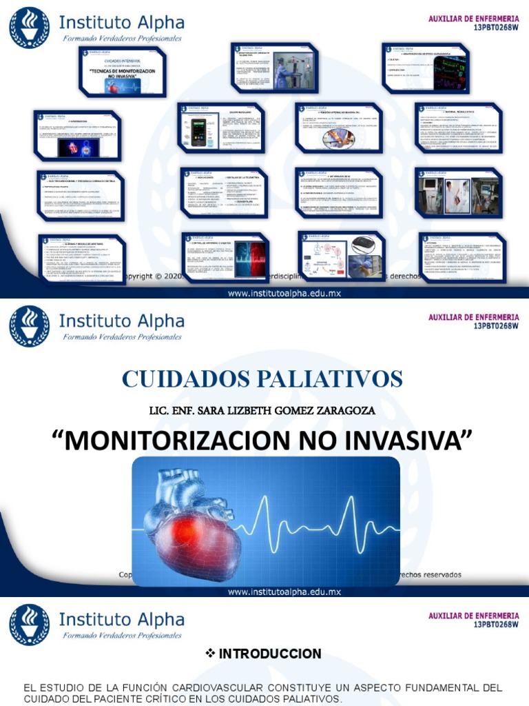 Monitorizacion No Invasiva 1 | PDF | Electrocardiografia | Corazón