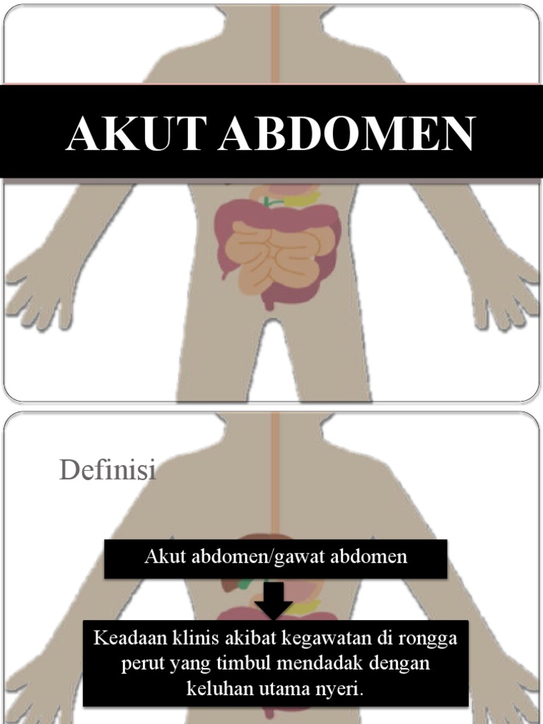Akut Abdomen | PDF