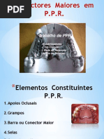 Grampos em PPR - Resumo | PDF | Dente