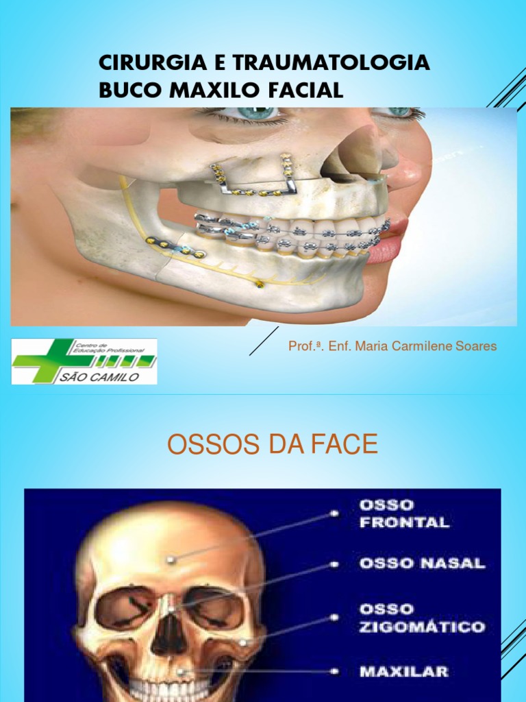 Instrumentos em Cirurgia Buco-Maxilo-Facial | PDF | Cirurgia oral e ...
