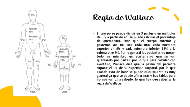 Regla de Wallace | PDF