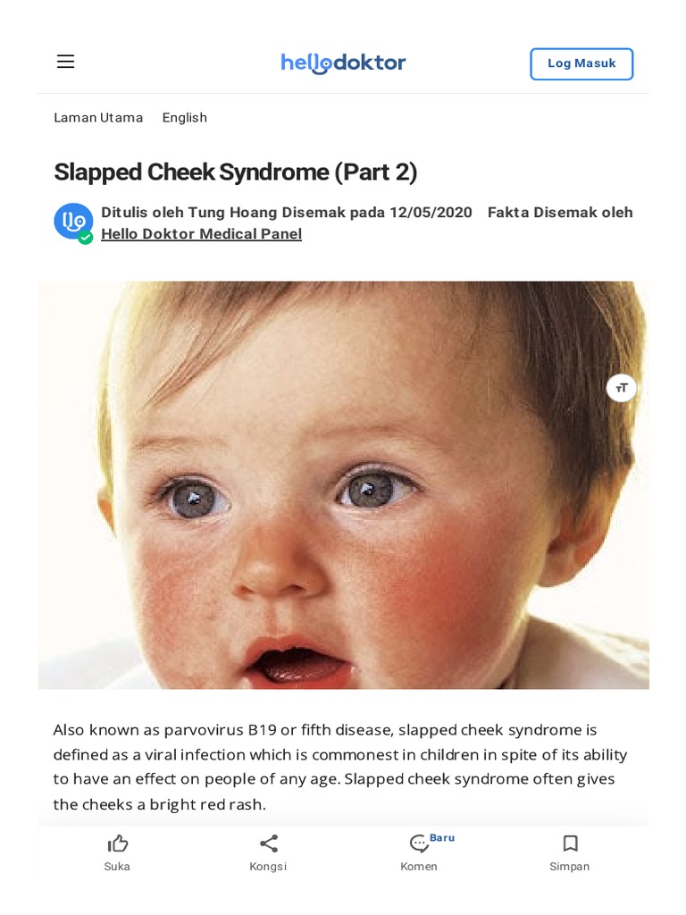 Slapped Cheek Syndrome (Part 2) - Hello Doktor | PDF | Infection ...