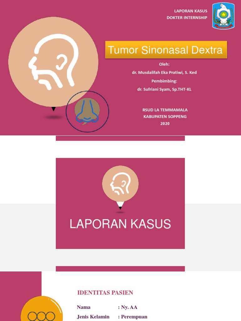 Tumor Sinonasal - Tiwi | PDF