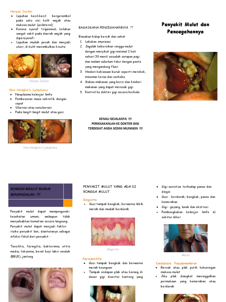 Leaflet Penyakit Mulut | PDF