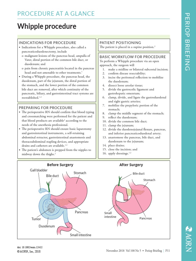 Whipple Procedure | PDF | Causes Of Death | Digestive System