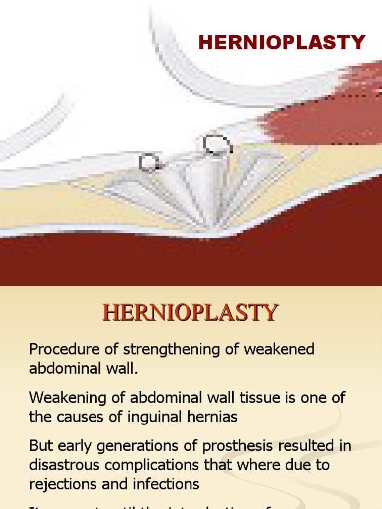 Hernioplasty | PDF | Surgery | Clinical Medicine