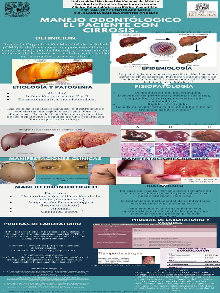 Cirrosis Infografia | PDF | Cirrosis | Especialidades Medicas
