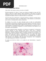 Optoquina | PDF | Estreptococo | Microbiología