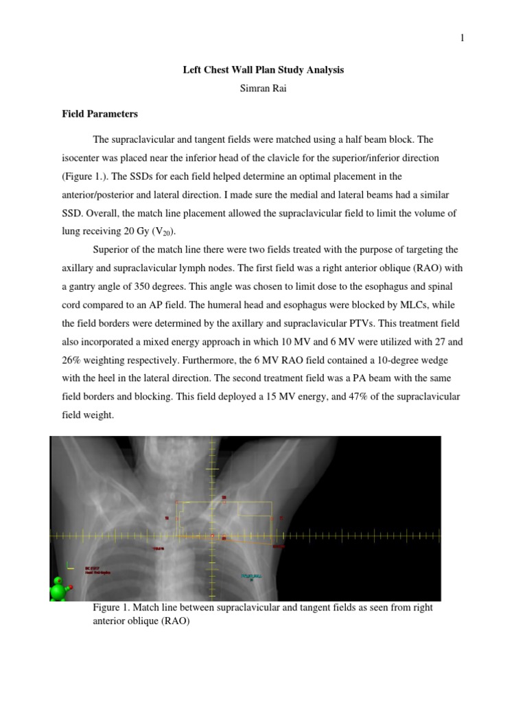 Chestwall Plan Discussion | PDF | Heart | Radiation Therapy