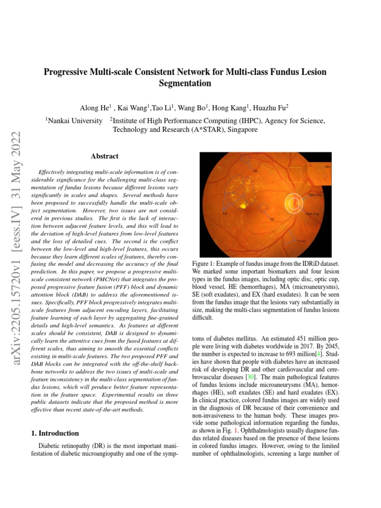 Progressive Multi-Scale Consistent Network For Multi-Class Fundus ... Progressive Multi-Scale Consistent Network For Multi-Class Fundus ...