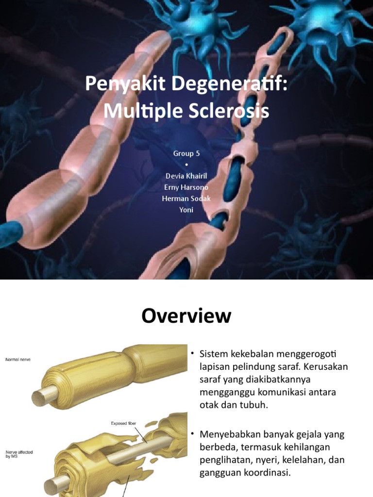 Multiple Sclerosis | PDF