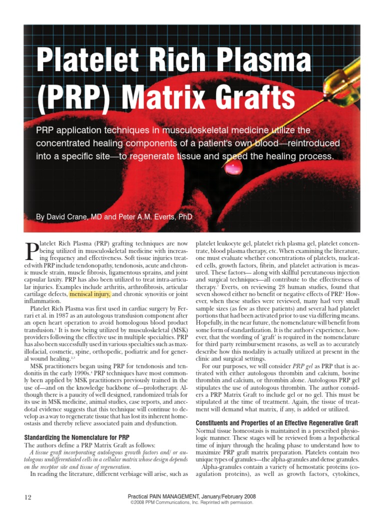 Platelet Rich Plasma (PRP) Matrix Grafts: by David Crane, MD and Peter ...
