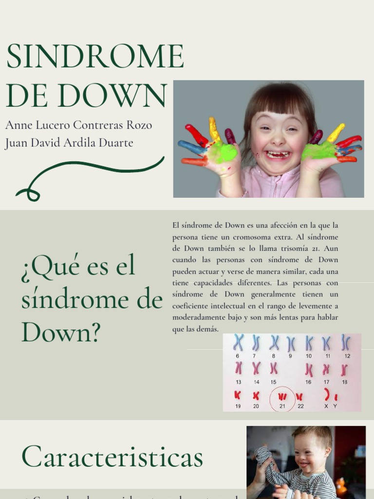 Sindrome de Down | PDF | Síndrome de Down | Diagnostico medico