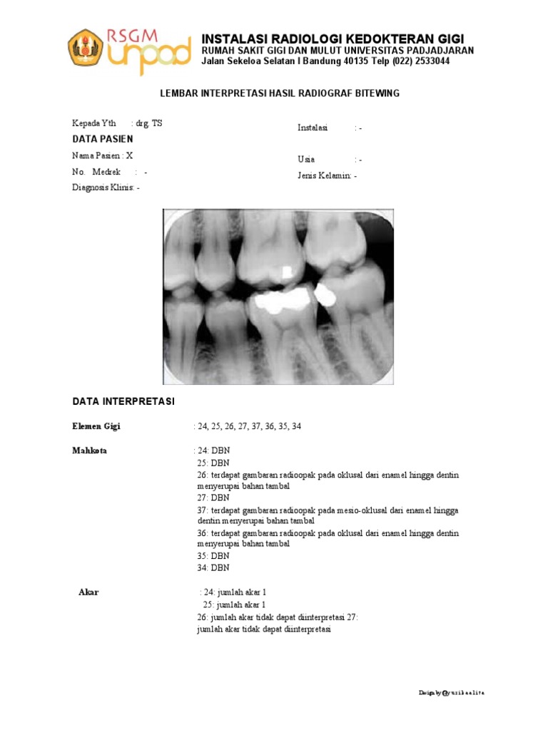 Interpretasi Radiografi Bitewing Gigi | PDF