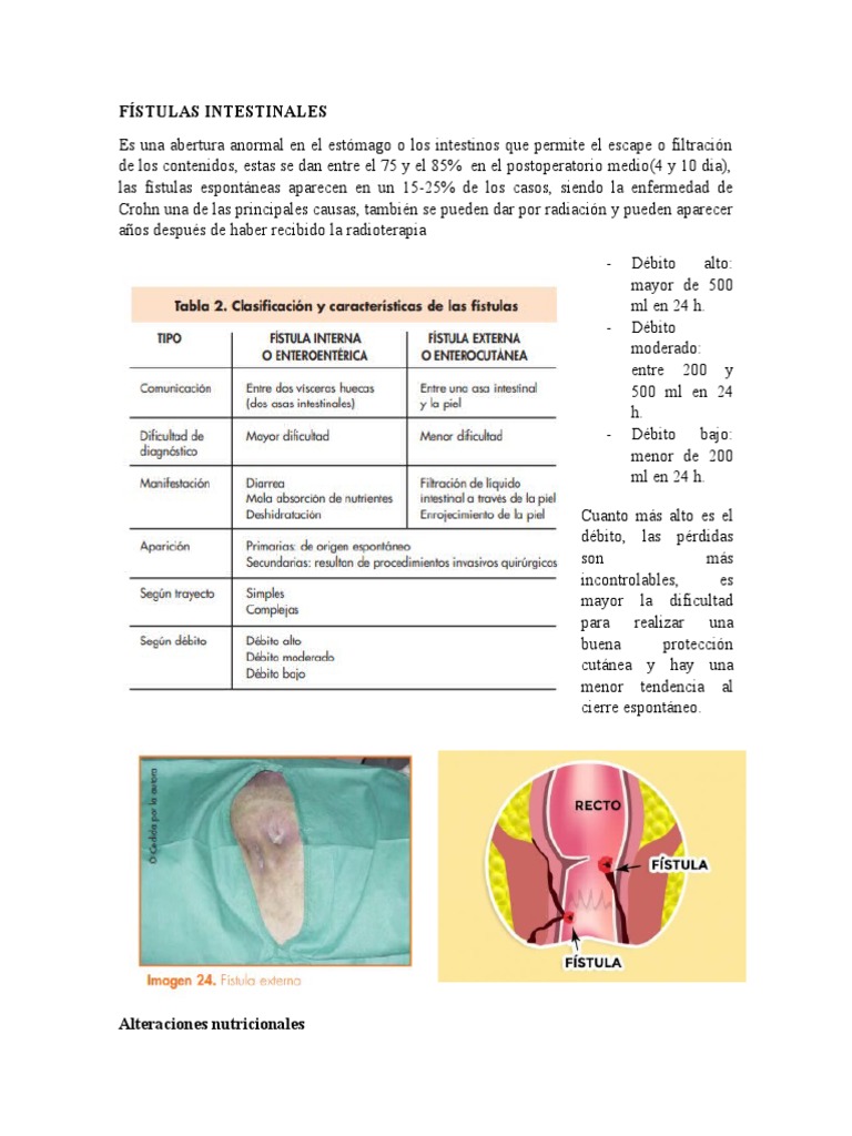 Fístulas Intestinales | PDF | Intestino grueso | Tracto gastrointestinal