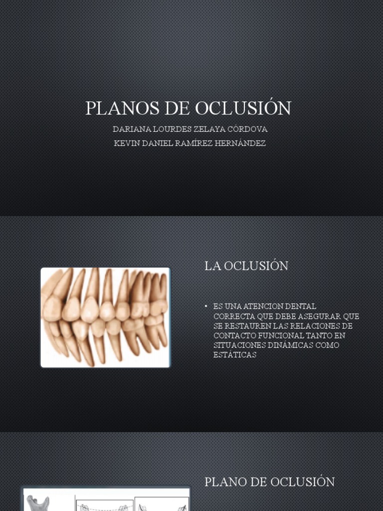 Planos de Oclusión | PDF