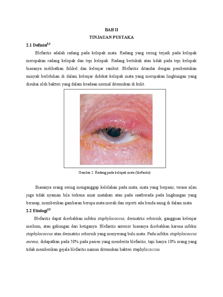 Panduan Lengkap Blefaritis: Definisi, Penyebab, dan Klasifikasi | PDF