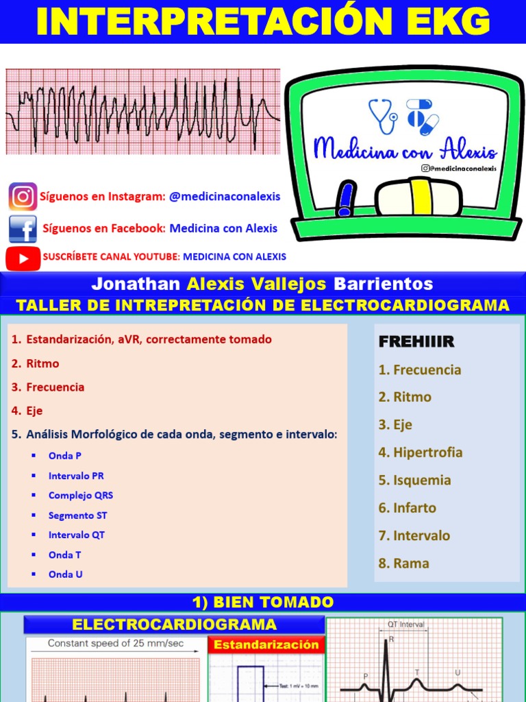 Taller Interpretación de Ekg | PDF | Electrocardiografia | Sistema circulatorio
